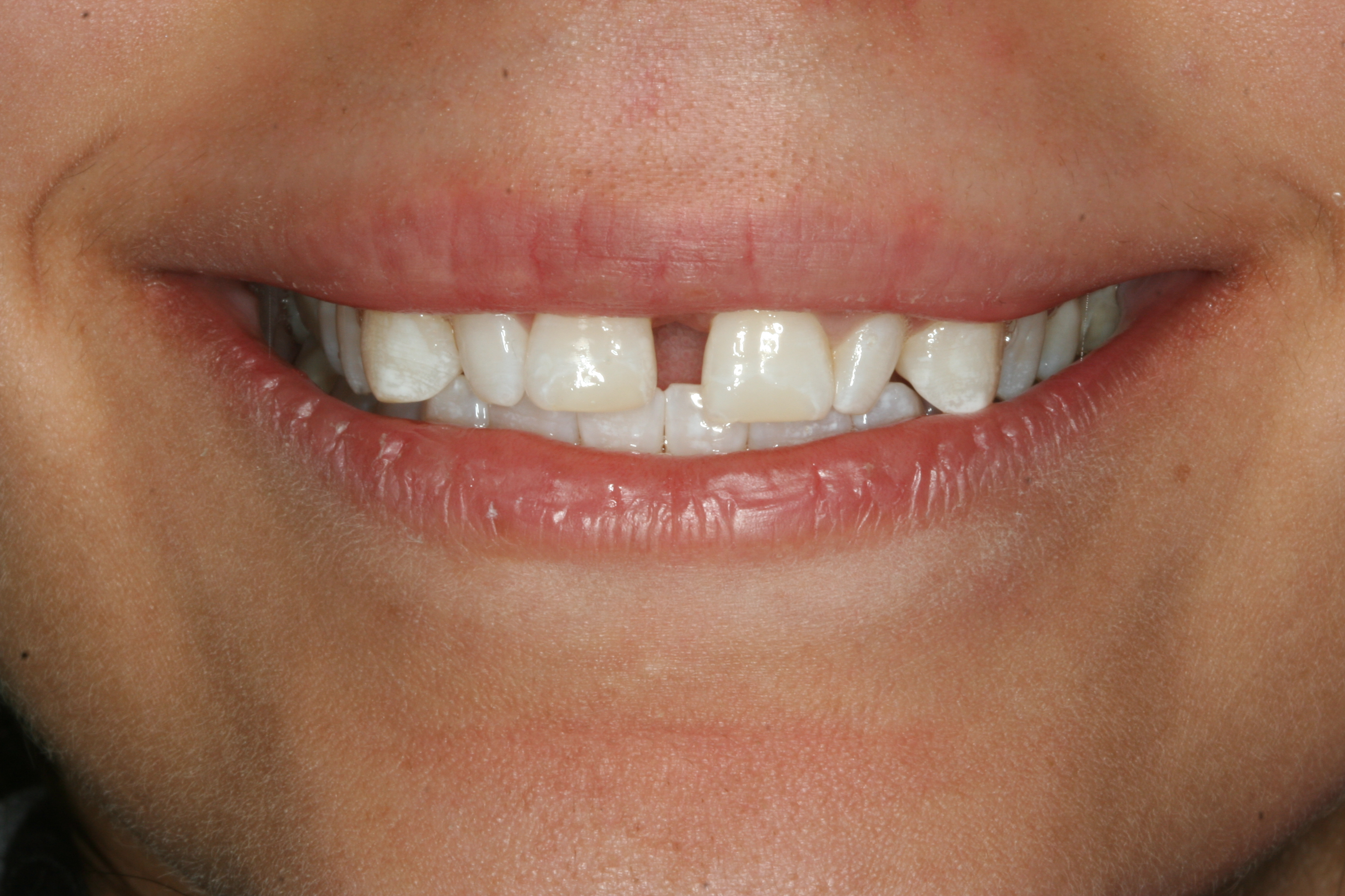 Dental Smile Gallery - Chicago Dental Solutions