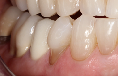 Dental Smile Gallery - Chicago Dental Solutions